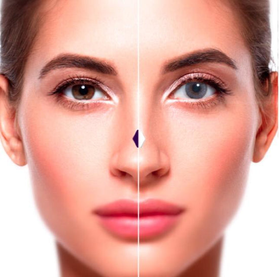 SOLOTICA CONTACT LENSES NATURAL GRAFITE/GRAPHITE – Billionaire Beauties